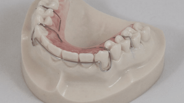 Life After Braces: Plastic and Wire Retainers - Orthodontic Associates